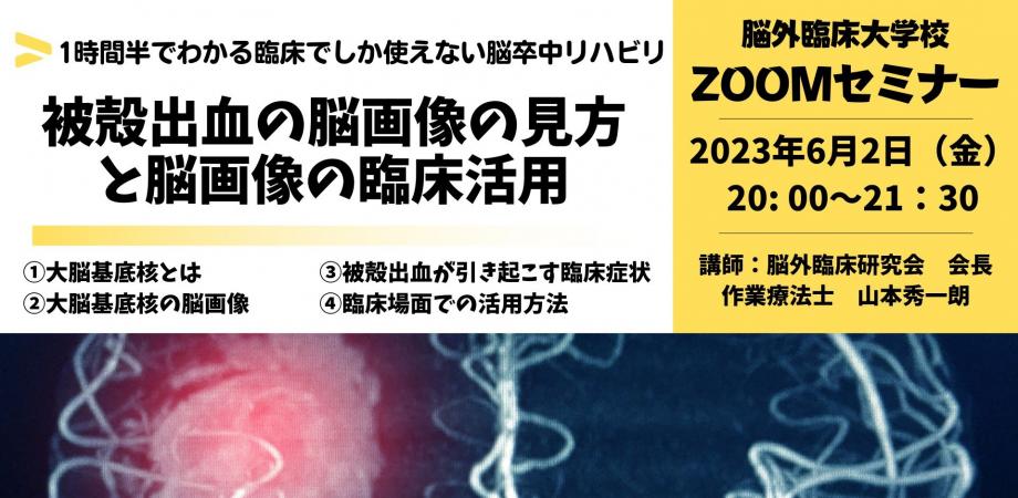 被殻出血の脳画像の見方と脳画像の臨床活用 | Peatix