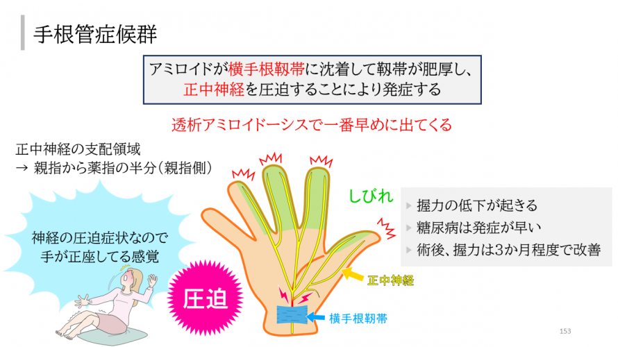 透析の合併症（5/20,5/21） | Peatix
