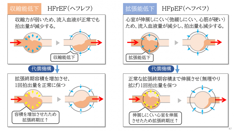 透析の合併症（5/20,5/21） | Peatix