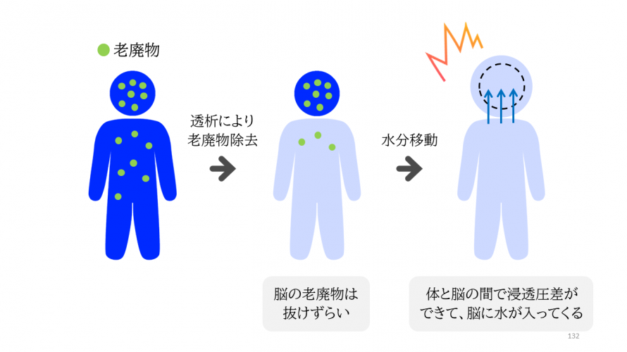 透析の合併症（5/20,5/21） | Peatix