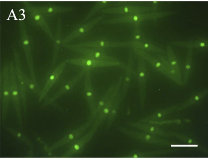 Analysis of sexual reproduction in Closterium | Sekimoto laboratory ...