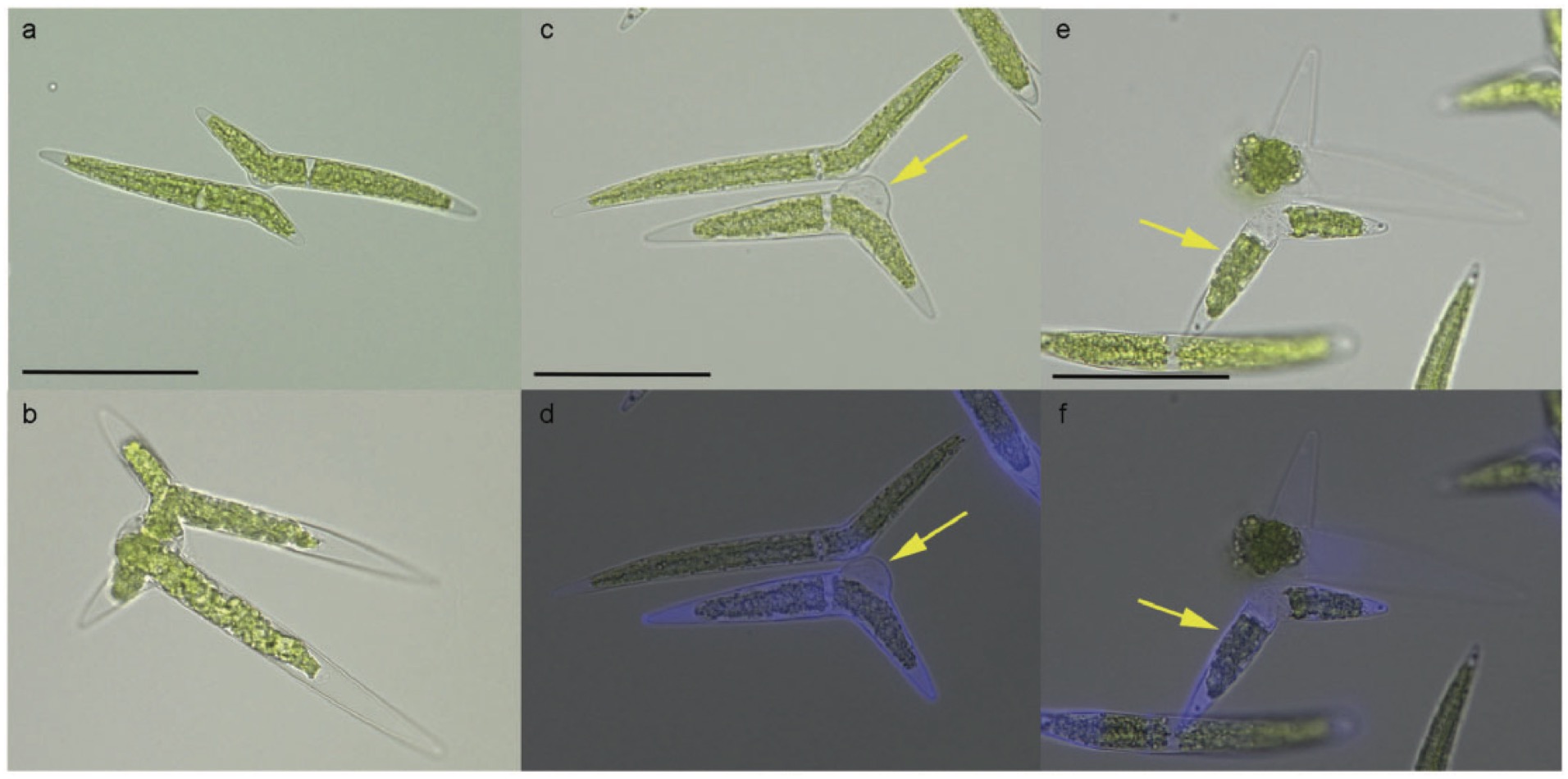 Analysis of sexual reproduction in Closterium | Sekimoto laboratory ...