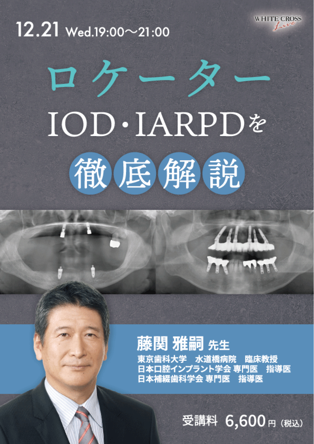 [録画配信]ロケーターIOD・IARPDを徹底解説 | WHITE CROSS