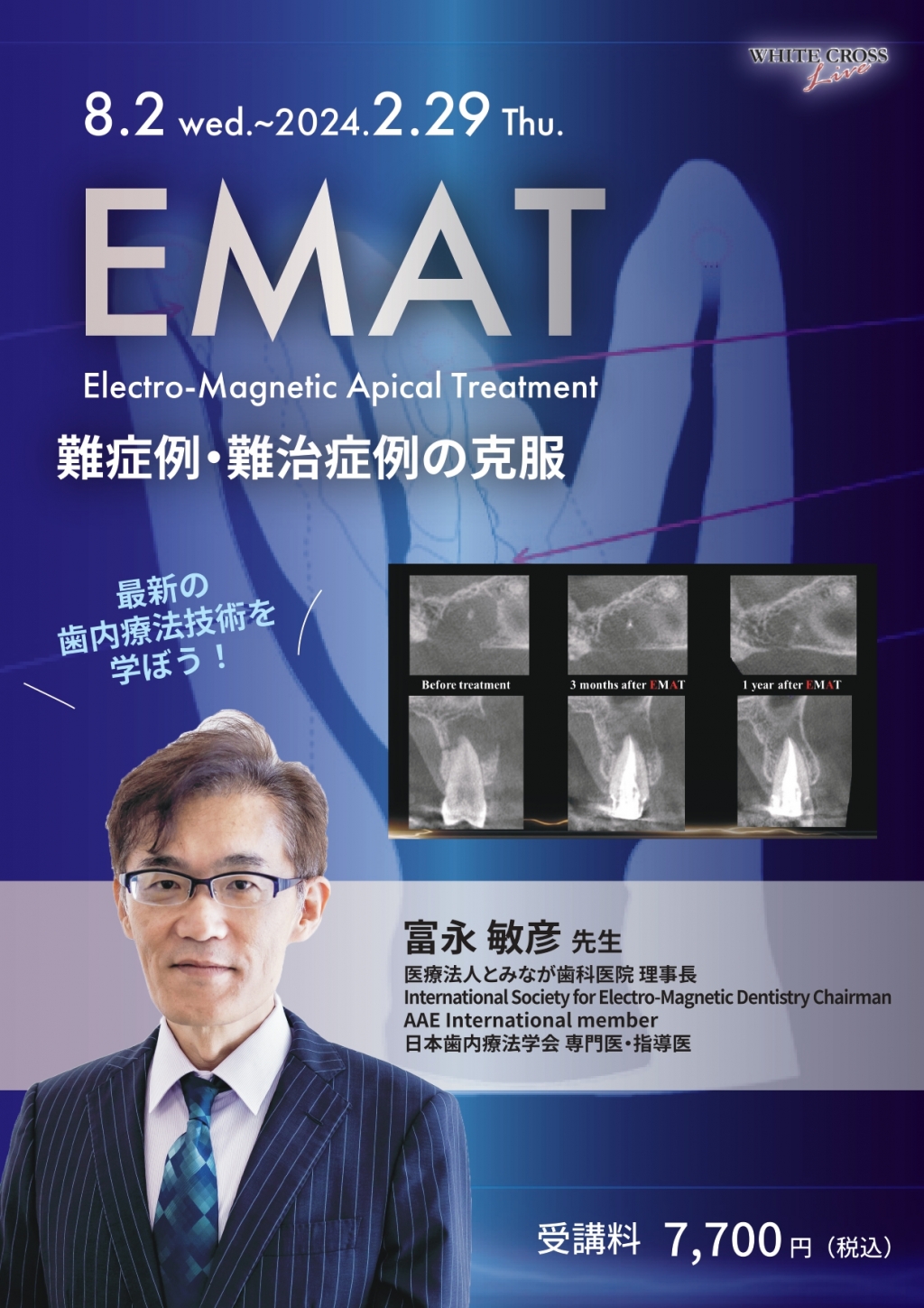 [VOD]最新の歯内療法技術を学ぼう！EMAT（Electro-Magnetic Apical Treatment）難症例・難治症例の克服 | WHITE CROSS
