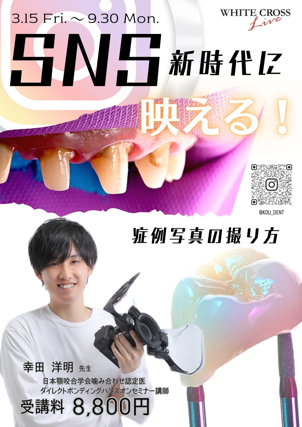 [VOD]SNS新時代に映える！症例写真の撮り方 | WHITE CROSS