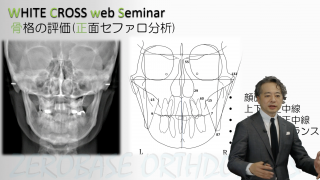 歯科矯正治療に必要な臨床診査、診断から治療計画立案まで〜実際の症例を通して考える〜 | WHITE CROSS