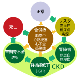 メタボ以上に怖い！？CKD（慢性腎臓病）とは？ | HelC（ヘルシー）