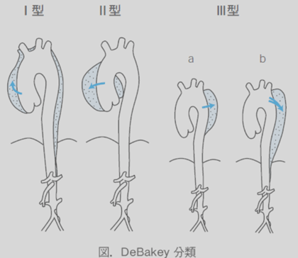 171：血管疾患（8）心臓血管外科のレジェンド DeBakey先生（望月吉彦先生） - ドクターズコラム | HelC（ヘルシー）